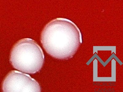 Acinetobacter On Macconkey Agar