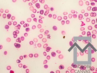 Acinetobacter Gram Stain