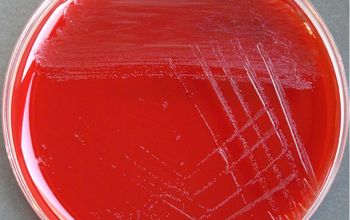 Actinobaculum schaalii