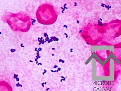 Corynebacterium Gram Stain
