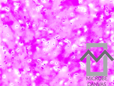 Enterobacter Aerogenes Motility Test