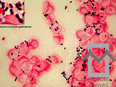 Enterococcus Gram Stain Morphology