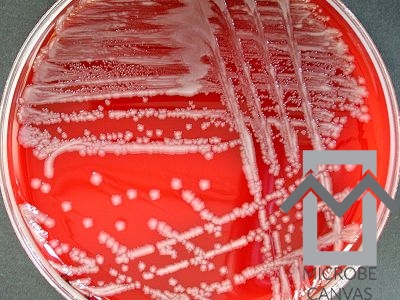 E Coli Plate Morphology