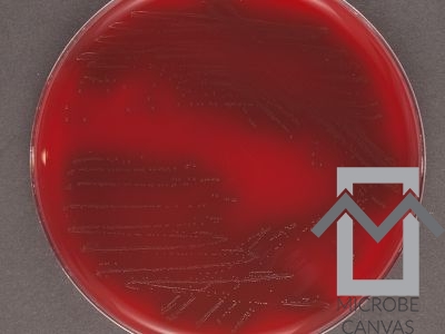 Haemophilus Blood Agar Sheep Blood Agar Royalty Free Images, Stock