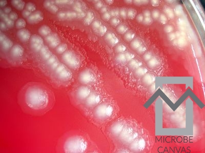 Proteus Mirabilis On Blood Agar