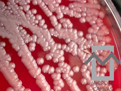 Serratia Marcescens Gram Stain