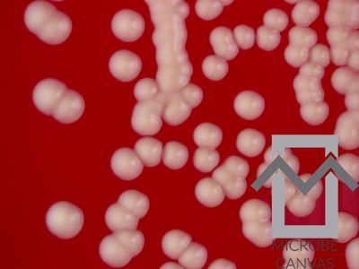 Staphylococcus Saprophyticus Gram Stain